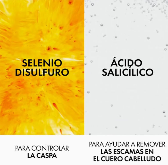 Dercos Shampoo Anticaspa Grasa Vichy 200 mL - Farmacias Klyns